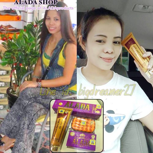 ALADA Super Fast Whitening Skin x10 Soap & Booster Lotion Set (USA 🇺🇸 ...