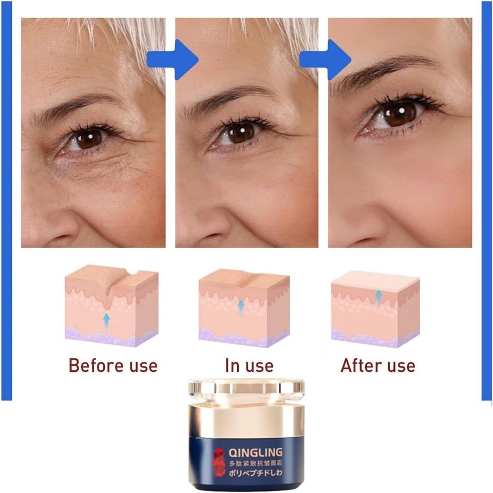 2 Pack Qingling Wrinkle Removal Cream – Anti Aging Face Cream ...