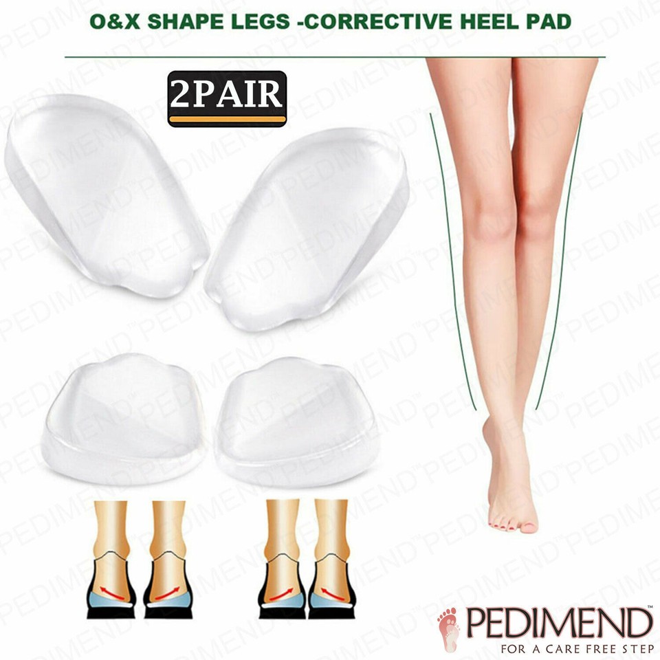 Supination & Pronation Corrective Heel Gel Pads Shoe Insoles for O/X ...