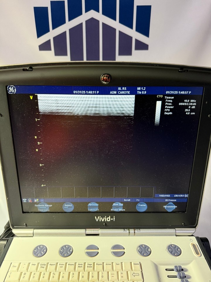 GE Ultrasound Vivid i BT12.2 2015. 3Sc-RS Cardiac & 8L-RS Probe . All Options On | eBay