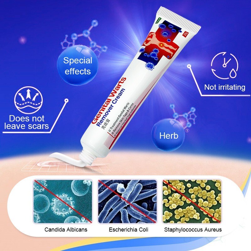 Genital Herpes Wart Remover Ointment Skin Tag Mole Acuminatum Treatment ...