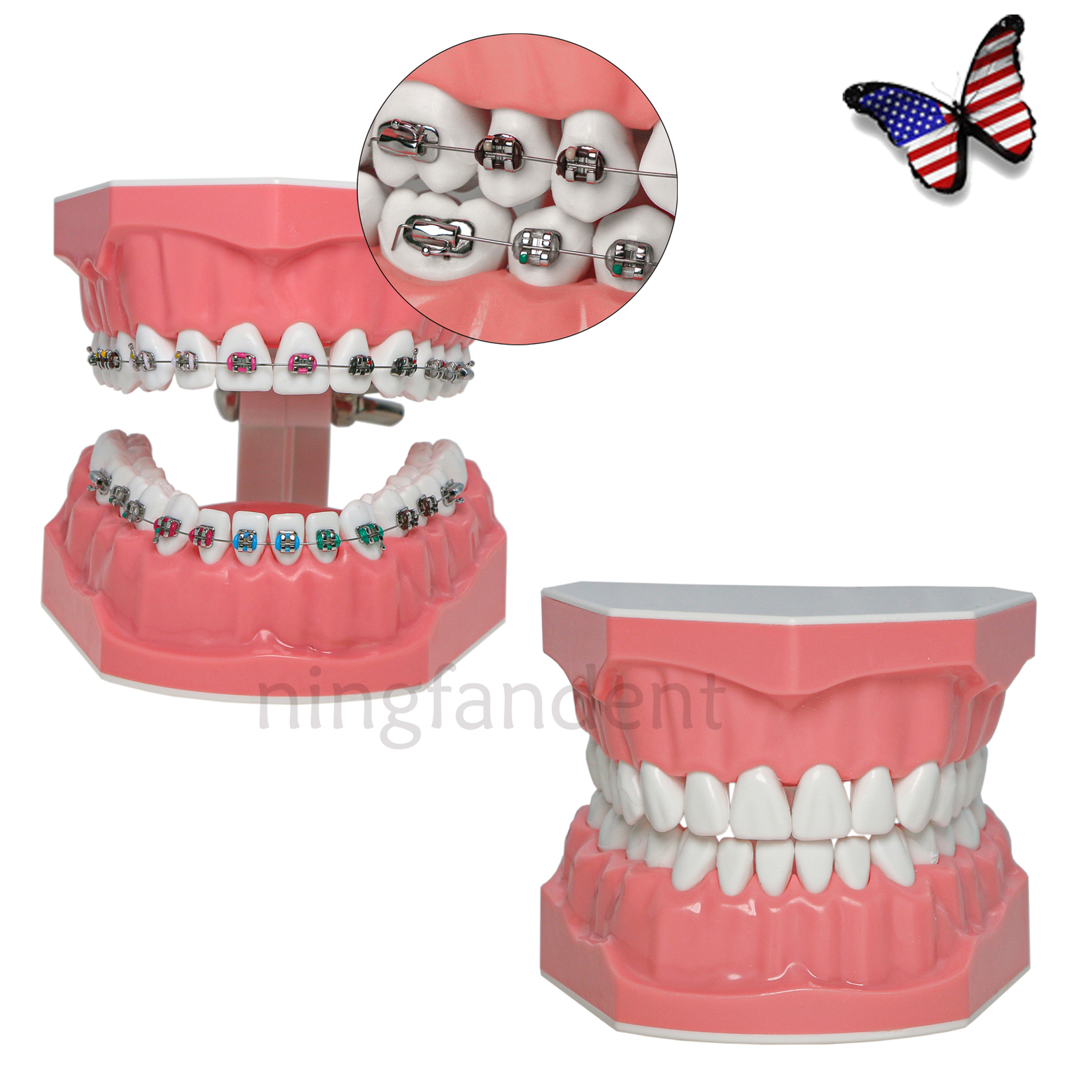 US Dental 1:1 Orthodontic Typodont Model Teeth Model with Brackets ...