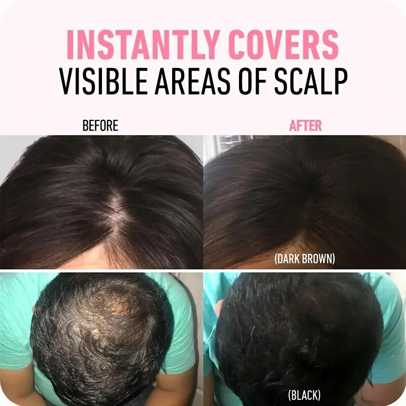 Waterproof Gray Hair Root & Bald Spot Powder for Scalp Coverage(SET OF ...