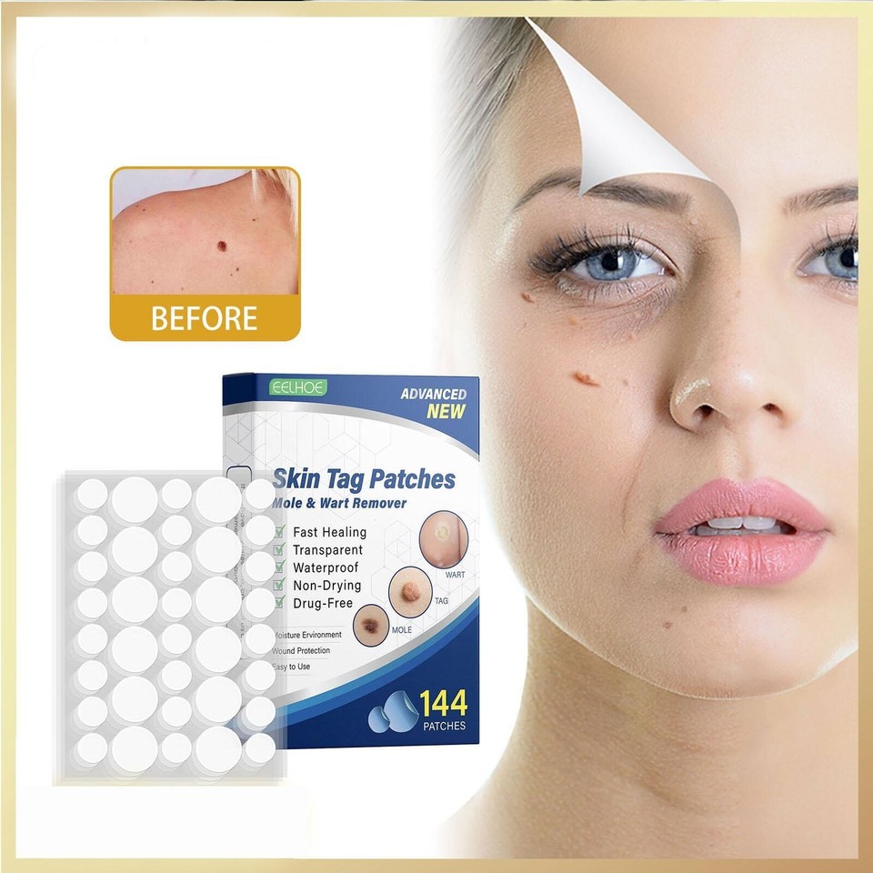 288× Skin Tag Remover Patches Quick Effective Mole and Wart Pad Removal ...