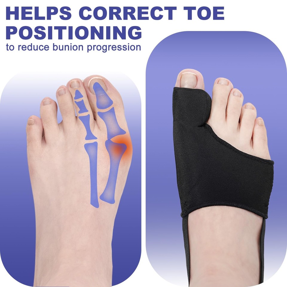 2 Pcs Bunion Corrector for Women & Men Big Toe Straightener-Bunions ...