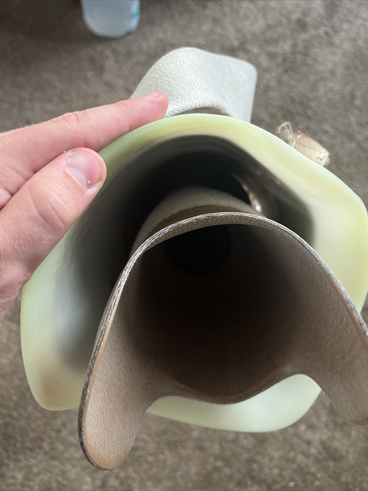 Endolite Prosthetic Above Knee Limb With Insert - Swing Phase Control ...