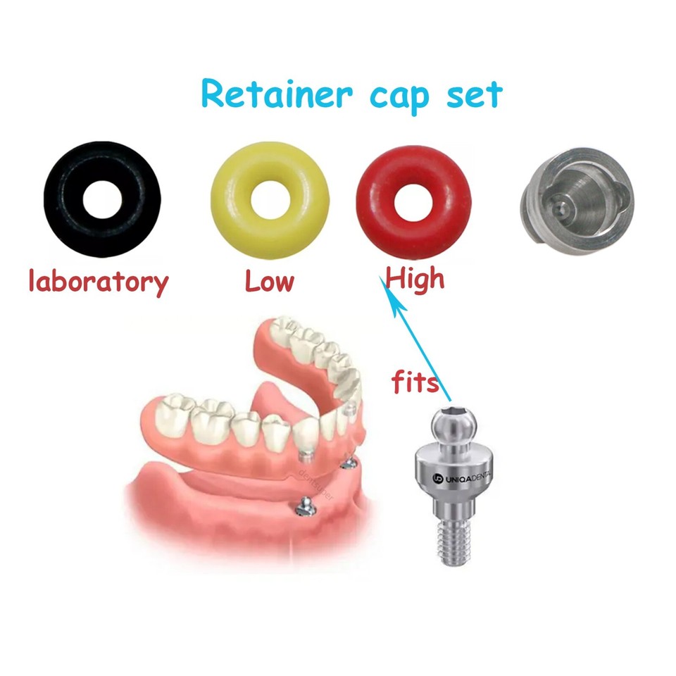 US Implant Ball Abutment O-Ring Retention Cap Set Dental Fit for ...