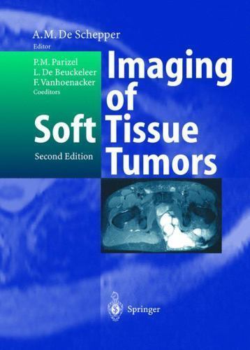 Imaging of Soft Tissue Tumors by P. M. Parizel (2001, Hardcover) for ...