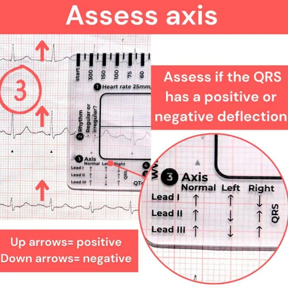 ECG Analysis & Interpretation (EKG) Medical EKG Cardiometer Ruler ...