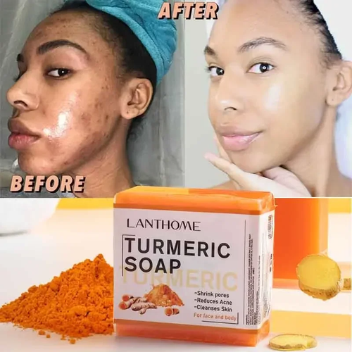 Tumeric Soap Acne Dark Spots Removal Skin Whitening Facial & Body ...