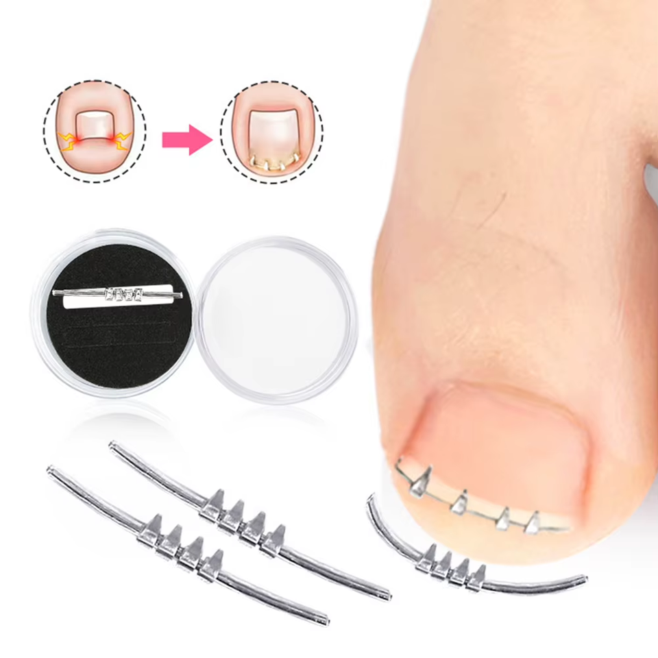 Ingrown Toenail Pedicure Tool Embed Toe Nail Care Straightening ...