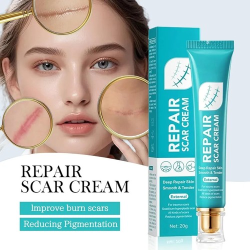 Best Scar removal Cream Skin Care for Scars Reduce Surgery Acne Stretch ...