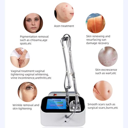 Skin Resurfacing Pigment Removal Face Lifting Co2 Fractional Laser ...