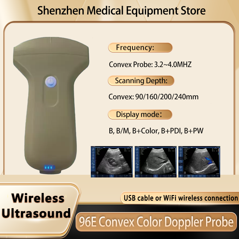 Portable Wireless Ultrasound Probe Scanner Support iOS Android Windows ...