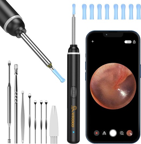 Doctor-Recommended Ear Scope - 1920P HD Camera with 6 LEDs & 8 Spoons ...