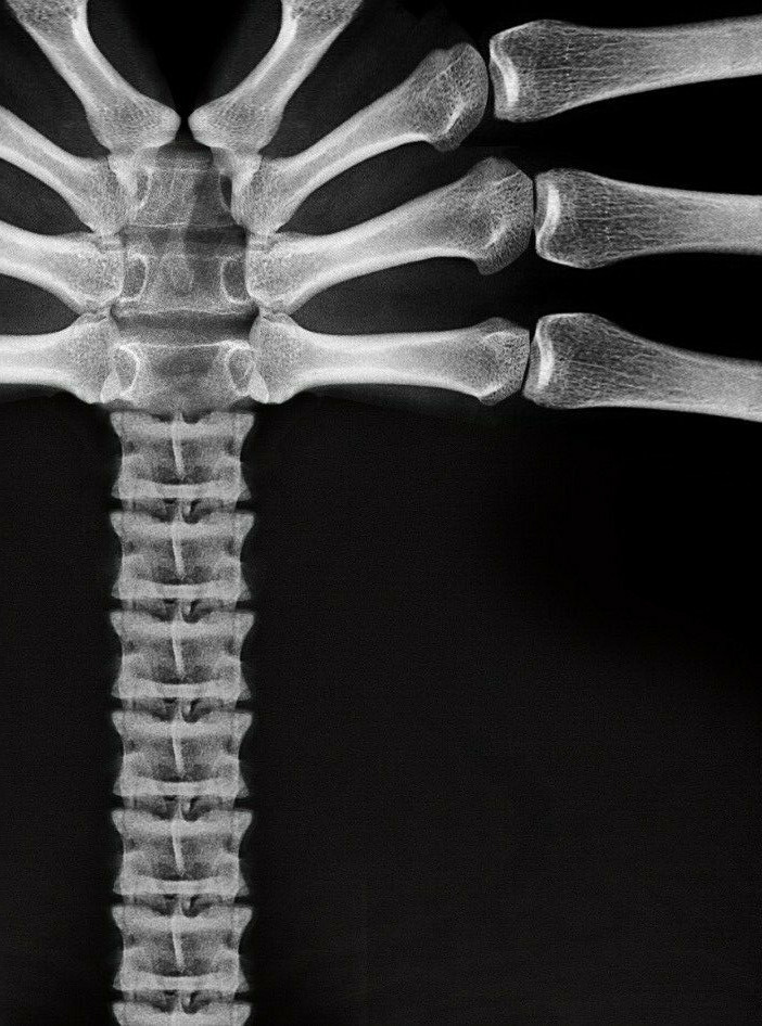 X-RAY on photographic film light box art Alien FaceHugger fan art ...