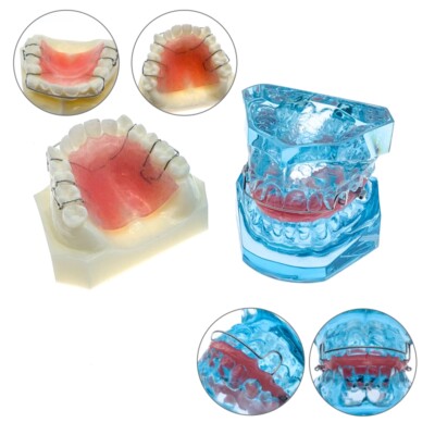 Dental Functional Orthopedic Bionator Removable/Hawley Retainer Teeth ...