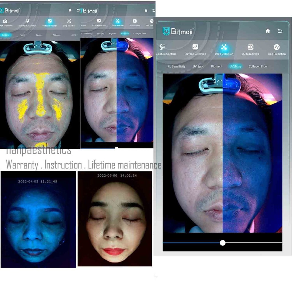 Professional 3D Face Skin Analyzer Scanner Machine Facial Analysis Skin ...