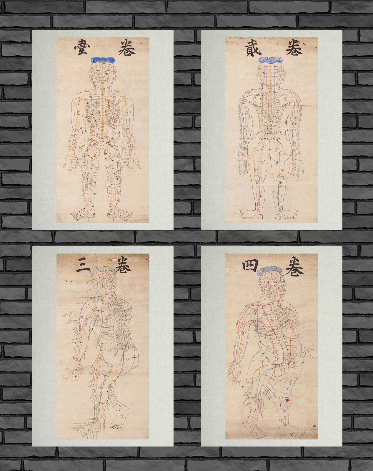 Needle Theraphy Acupuncture Body Chart Moxibustion Cupping | eBay