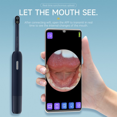 Dental Intraoral Camera Digital USB Imaging Focus Intra Oral 6 LED ...