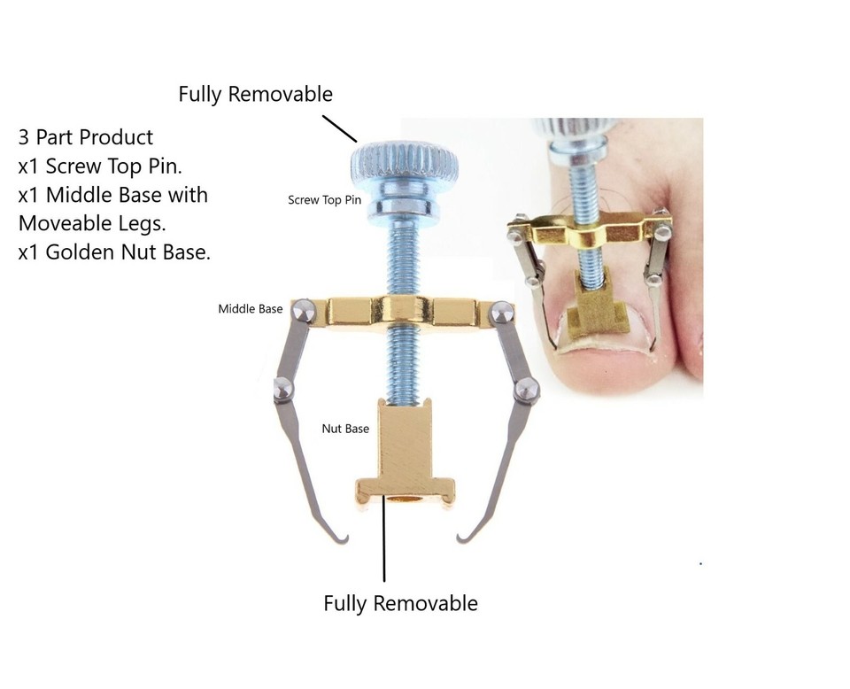 Ingrown Toenail Manicure Pedicure Foot Care Correction Brace Tool Toe ...