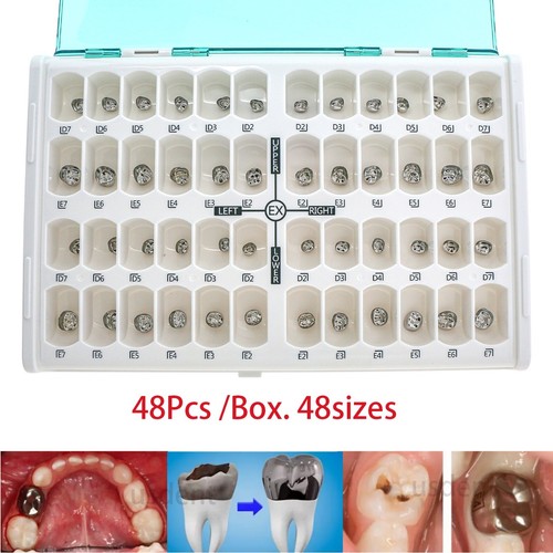 48Pc Dental Stainless Steel Crowns - Pediatric Primary Molars ...