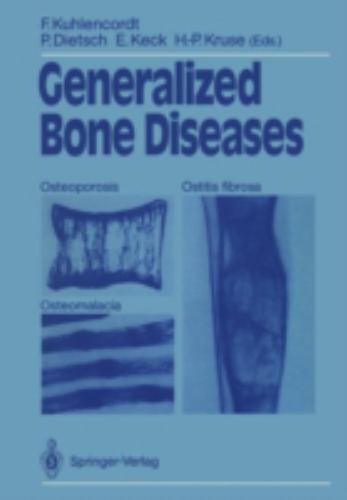 Generalized Bone Diseases : Osteoporosis - Osteomalacia - Ostitis ...