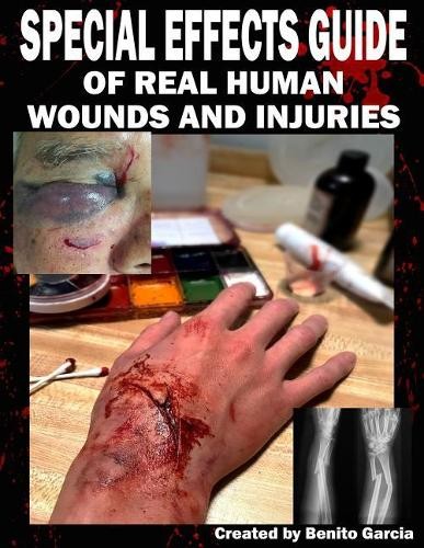 Benito Garcia Special Effects Guide Of Real Human Wounds (Paperback ...