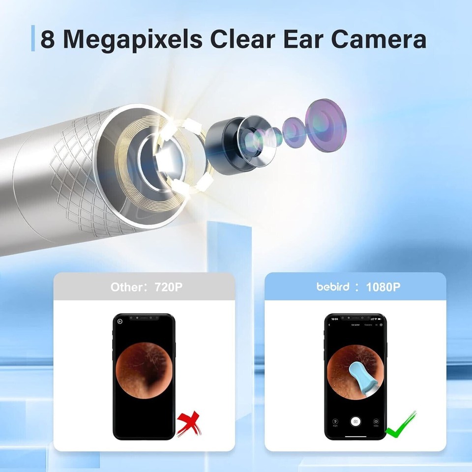 BEBIRD X17 Pro Camera Endoscope Professional Visual Ear Cleaner Ear Wax ...