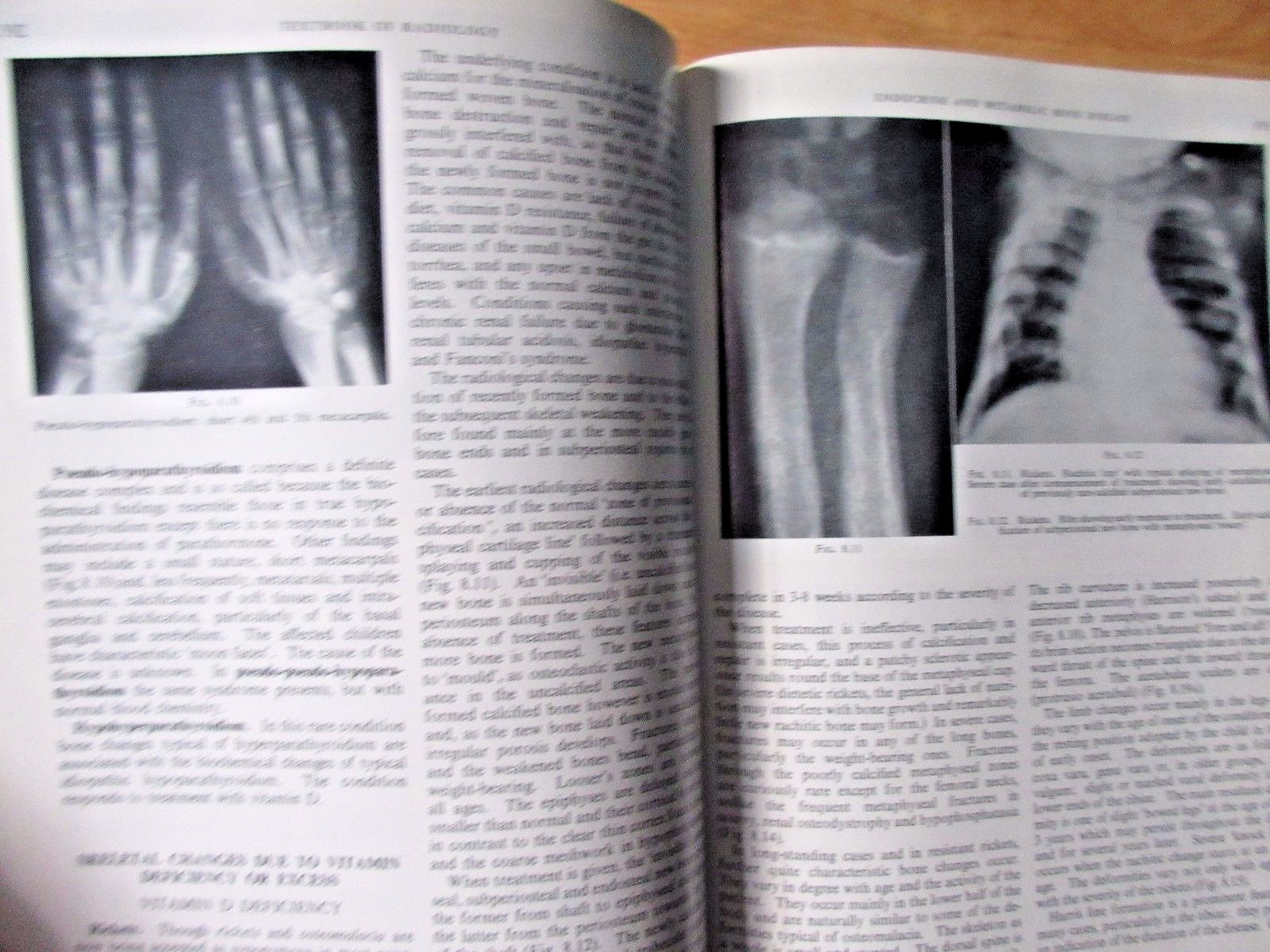 Textbook of Radiology David Sutton 1975 | eBay