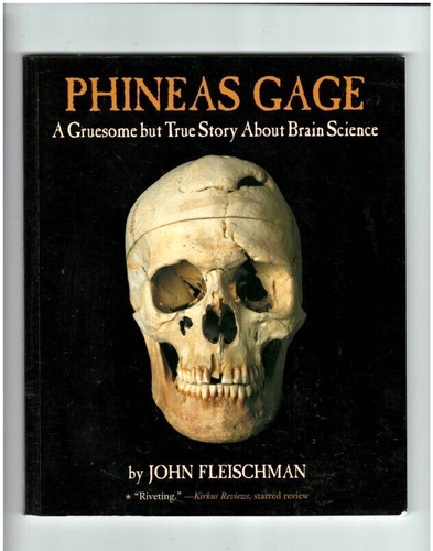 PHINEAS GAGE-1848 A 13 POUND IRON ROD SHOT THRU HIS BRAIN-HISTORY ...