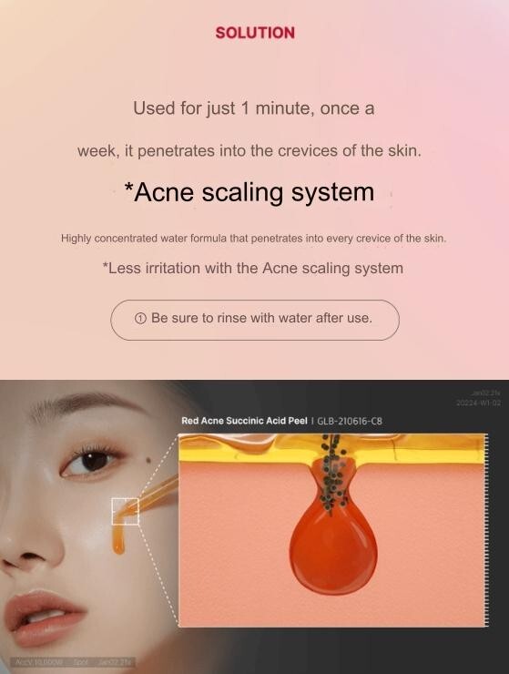 Medicube Red Acne Care Succinic Acid DeadSkin Sebum Control Blackhead ...