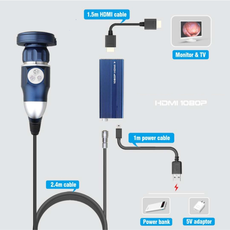 Portable Medical Endoscopy ENT Surgery HDMI USB Full HD 1080P Endoscope ...