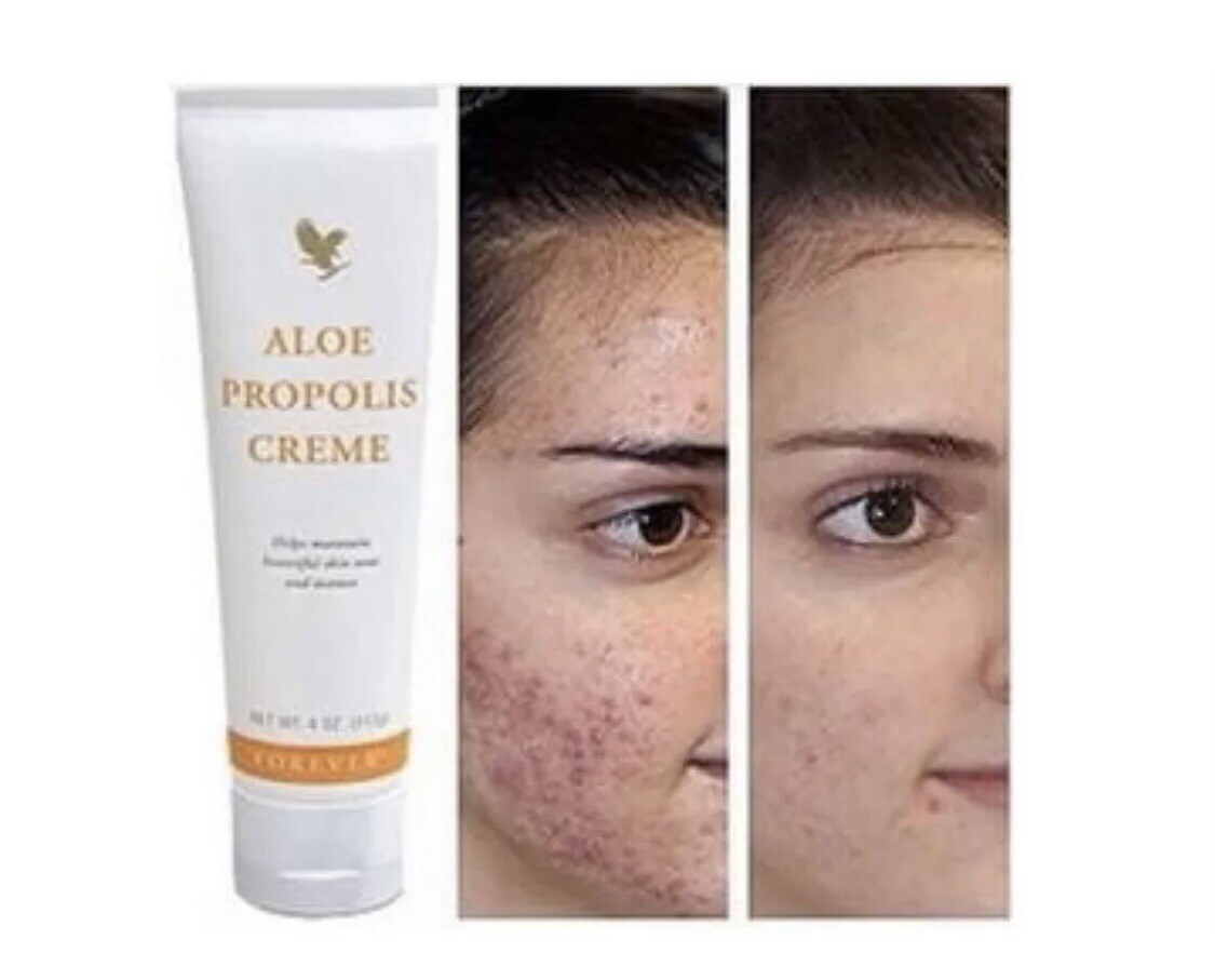 6 pack - Forever Living ALOE PROPOLIS Creme | eBay
