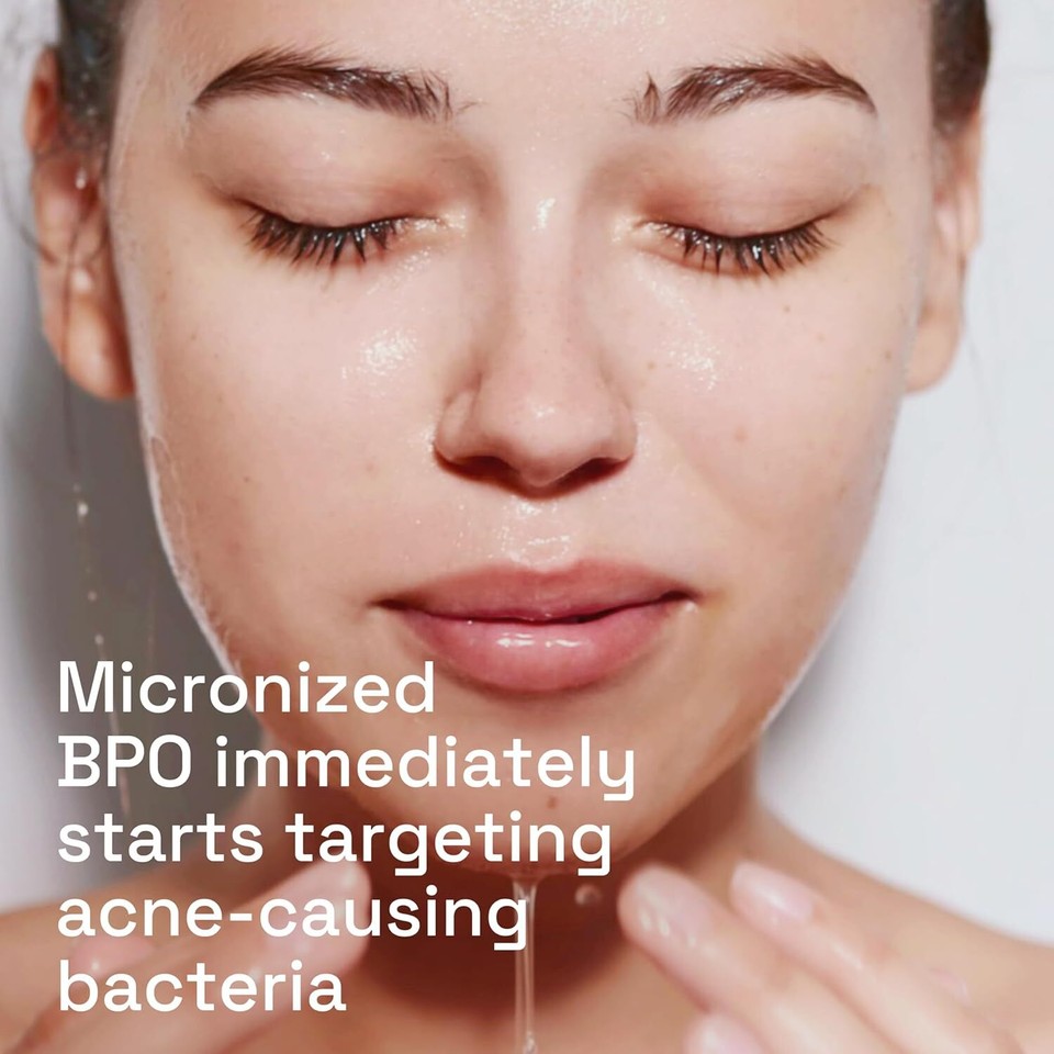 Cetaphil Gentle Clear Complexion-Clearing BPO Acne Cleanser with 2.6% ...