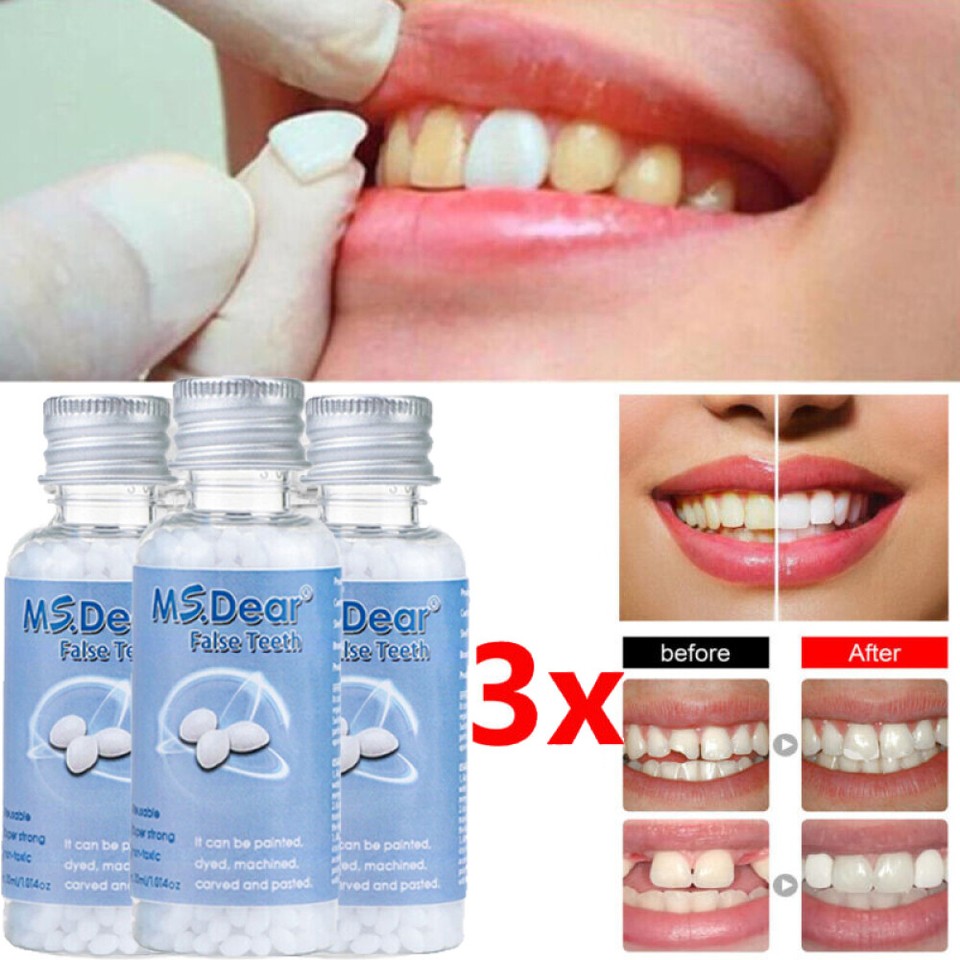 Temporary Strong Teeth Tooth Repair Dental Cement Cavity Filling Kit ...