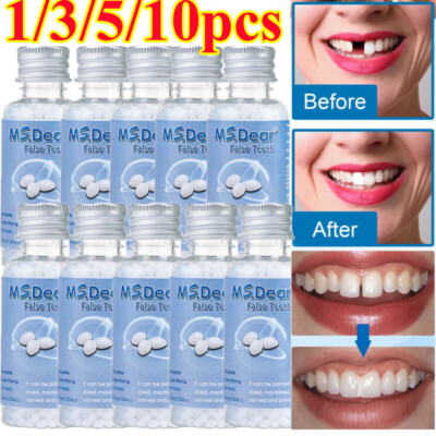 Tooth Repair, Replacement Missing Teeth Gap Filler, Temporary Moldable ...