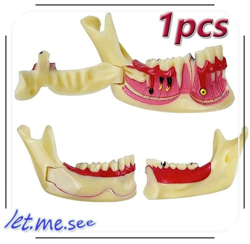 Dental Teeth Low Jaw Bone Tissue Mandible Anatomical Jawbone Mandibular ...