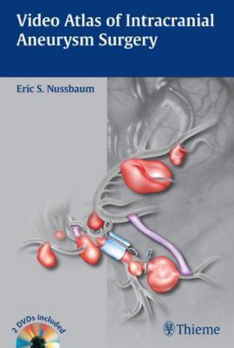 Video Atlas of Intracranial Aneurysm Surgery by Eric Nussbaum (2012 ...