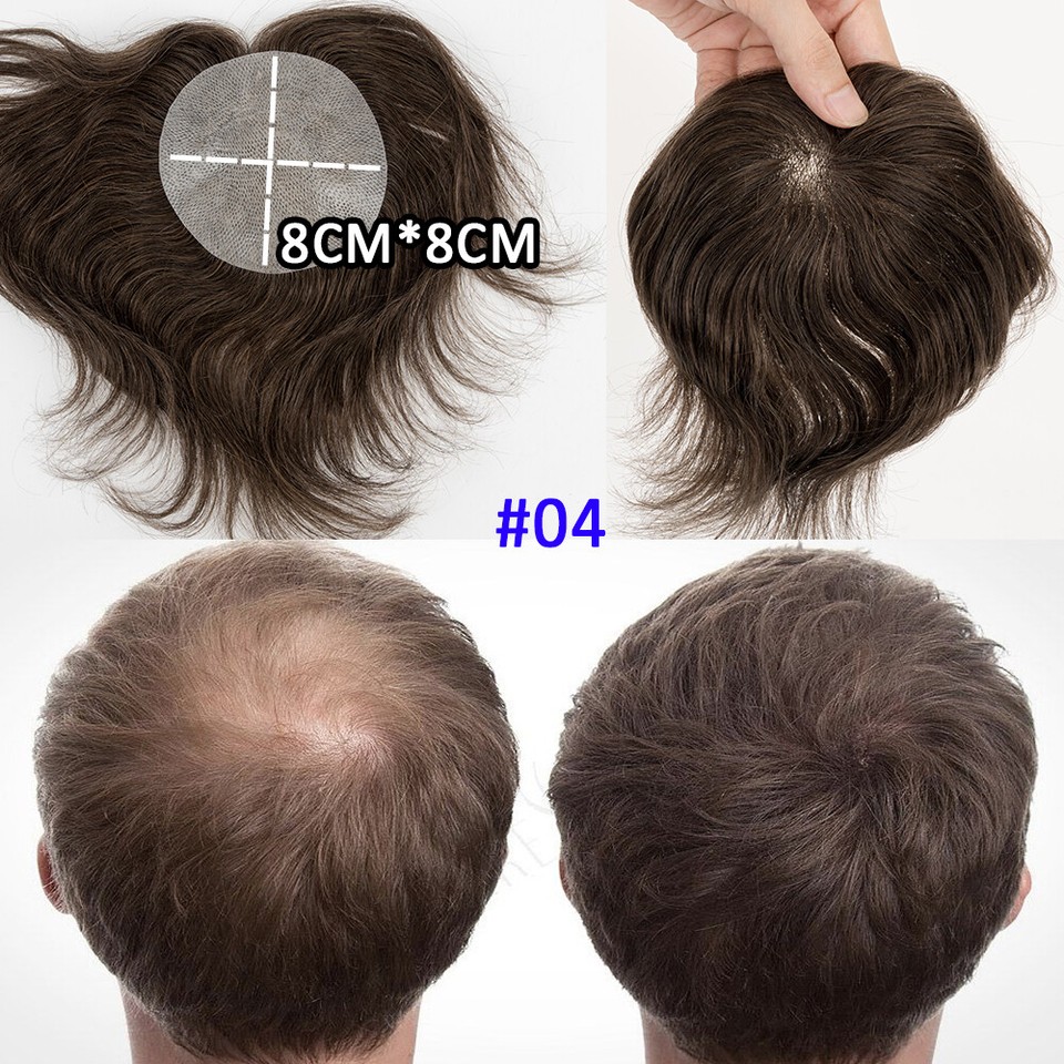 Bald Spot Hair Patch Toupee for Men Full PU Skin Base Cover-up Hair ...