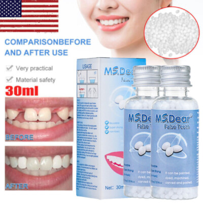 2X Tooth Repair Kit - Temporary Teeth Replacement Kit for Missing ...