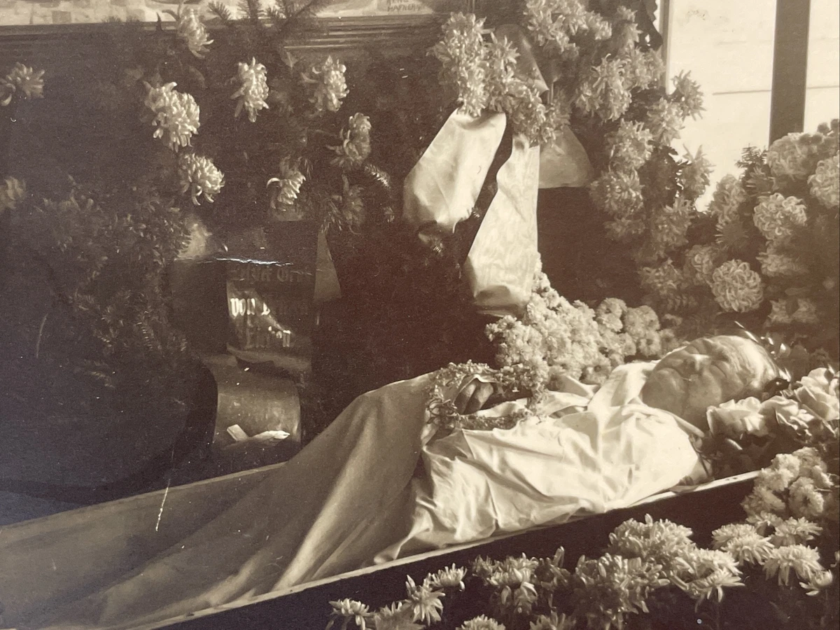 Real Post Mortem Photos