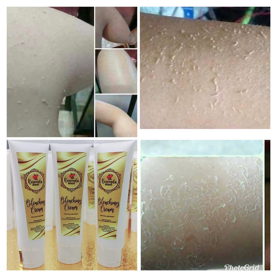 Dr. Alvin PSCF Orange Peel Lotion Orange Peel Soap Whitening Remove ...