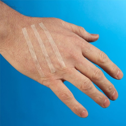 30x STRILE SKIN CLOSURE STRIPS 75mm LONG Suture Stitch Bandage Dressing ...