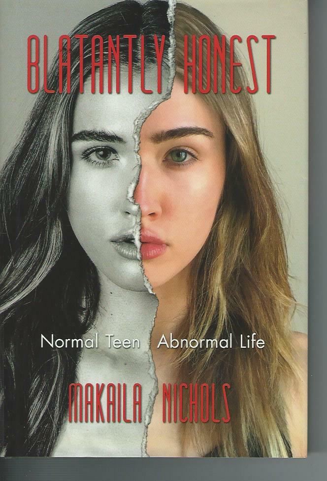 Blatantly Honest : Normal Teen, Abnormal Life by Makaila Nichols (2016 ...