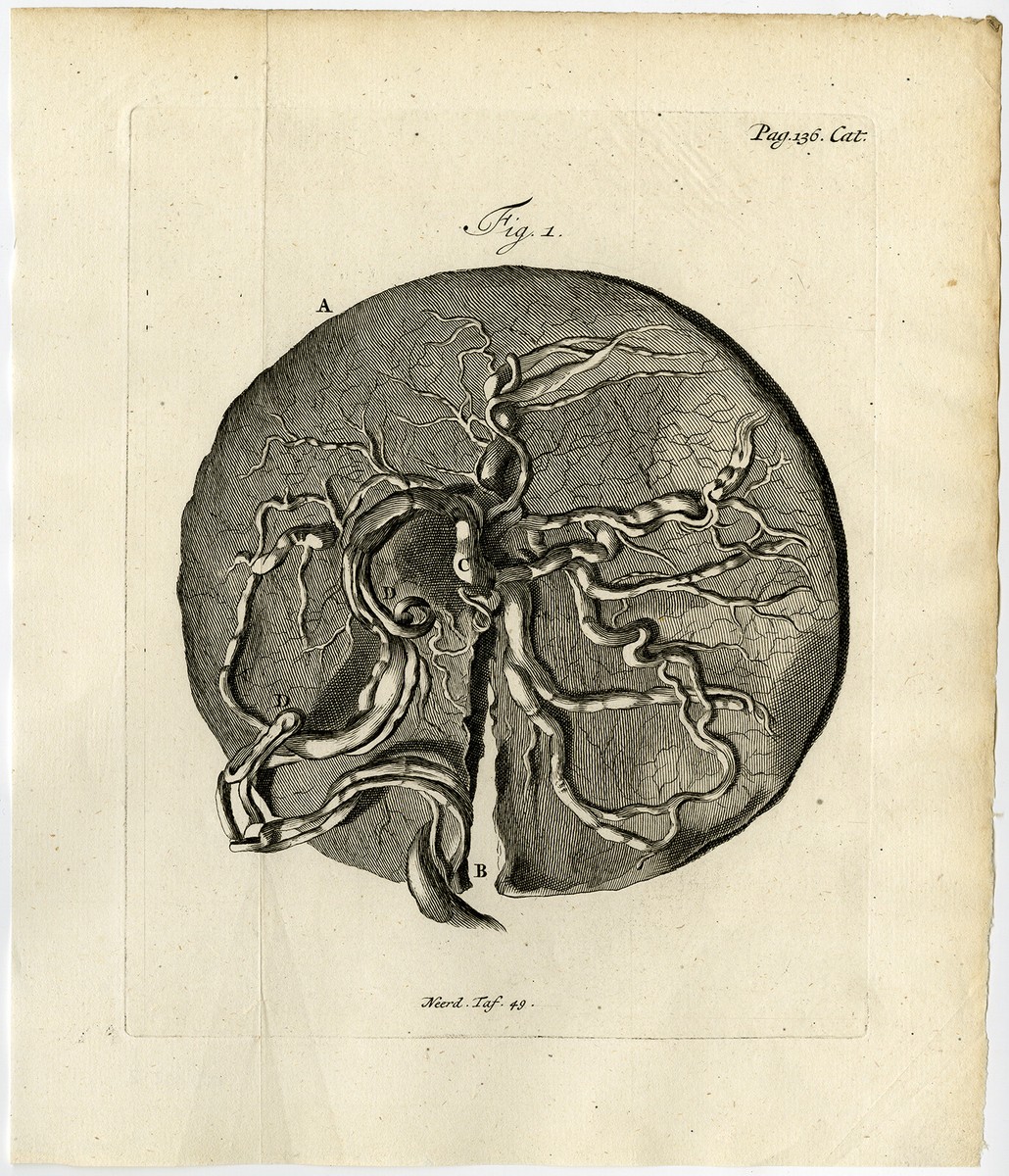 Umbilical Cord Drawing