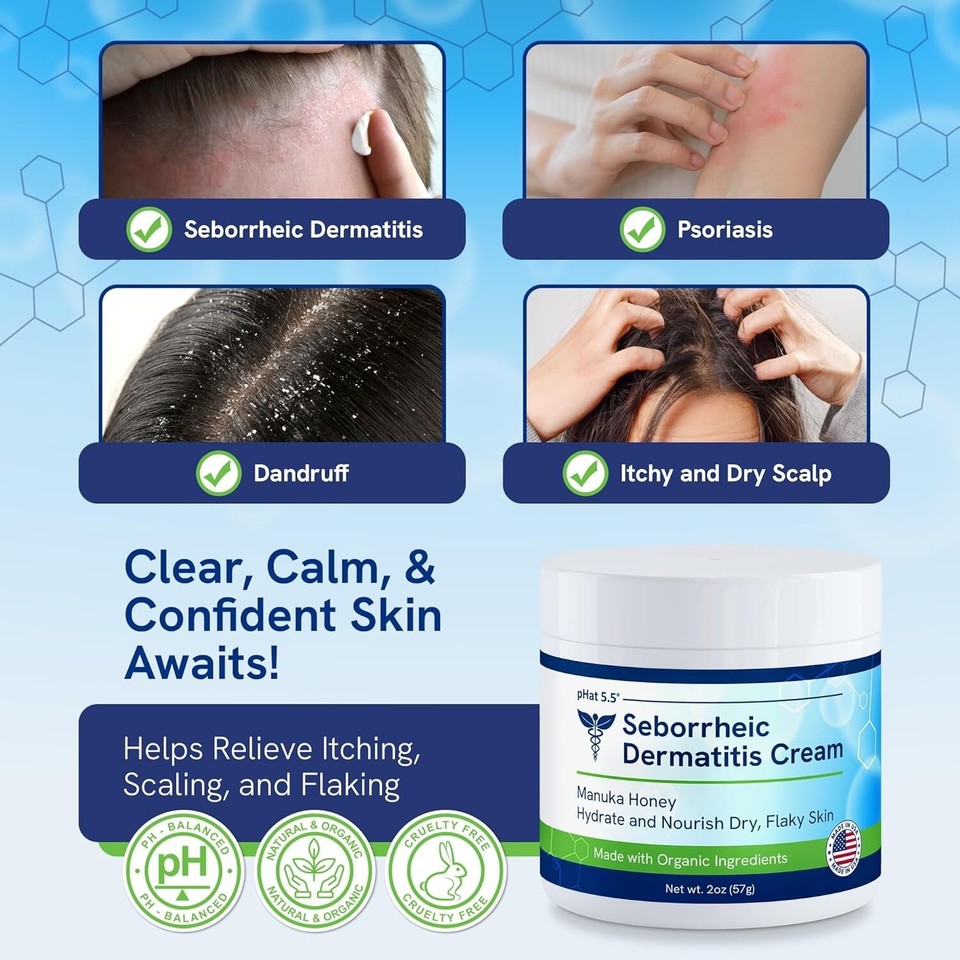 Seborrheic Dermatitis Cream with Manuka Honey, Coconut Oil and Aloe ...