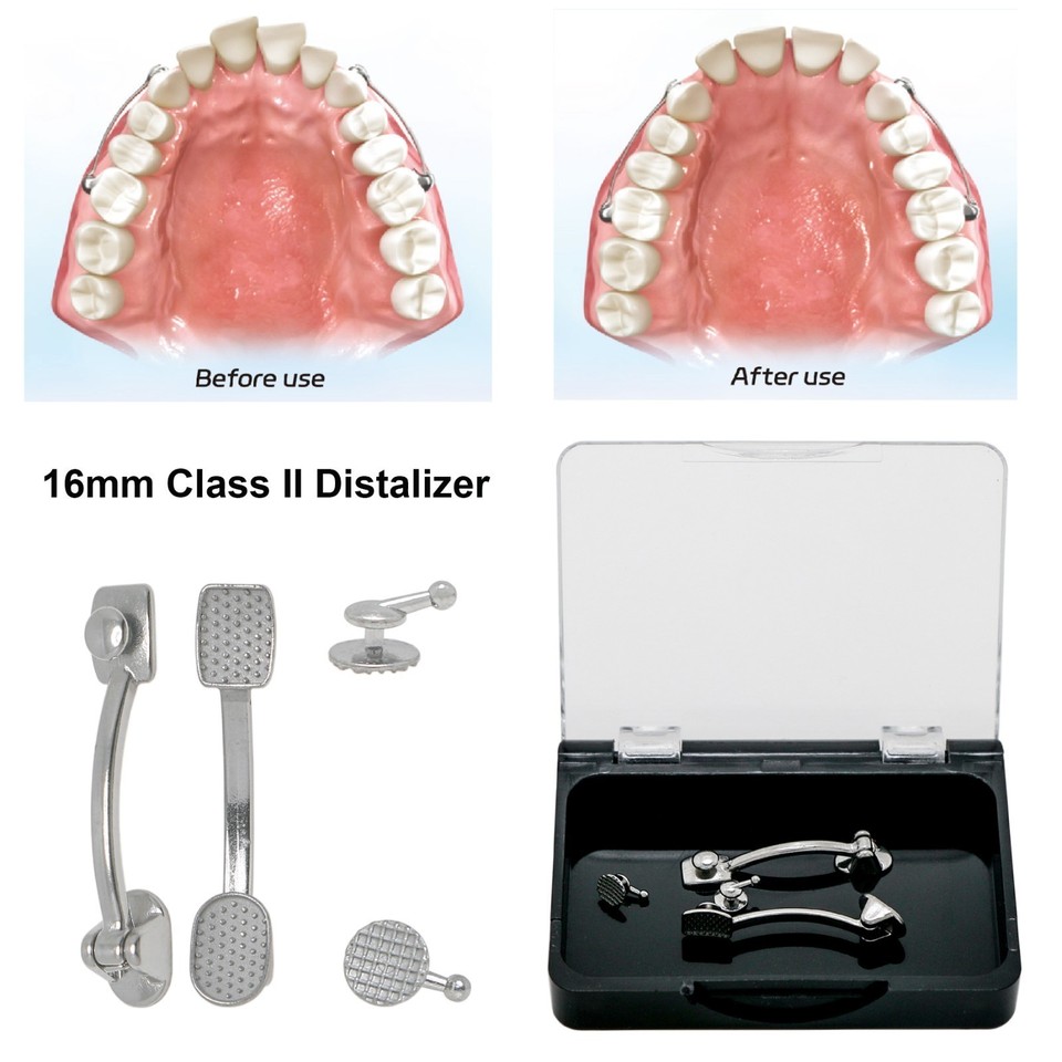 Orthodontic Treatment Carriere Motion Class II Appliances Distalizer ...