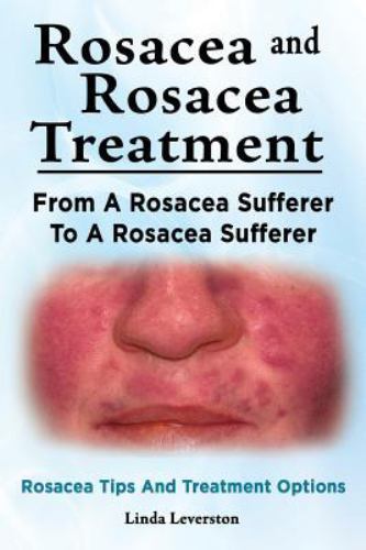 Rosacea and Rosacea Treatment. from a Rosacea Sufferer to a Rosacea ...