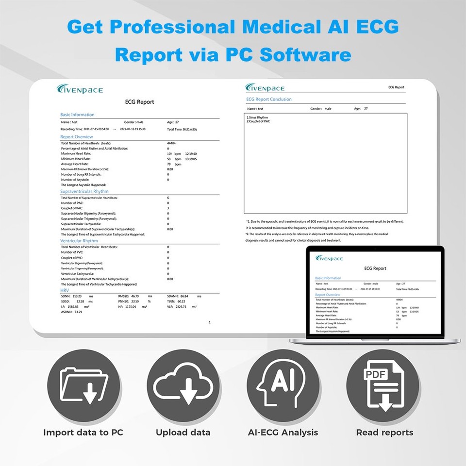 Livenpace Portable Dynamic ECG EKG Holter Recorder 24 Hours PC AI ...